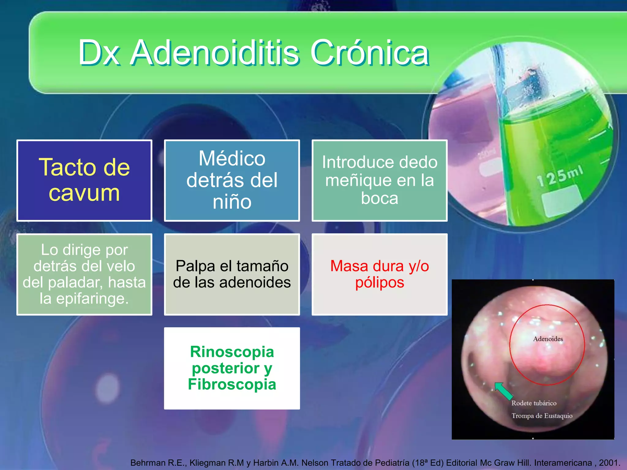 Adenoiditis y rinitis | PDF | Ear, Nose and Throat Conditions ...