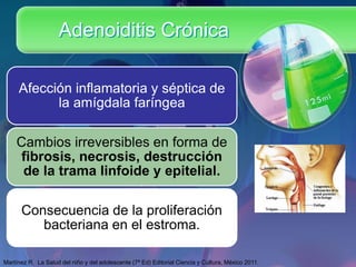 Adenoiditis y rinitis | PDF