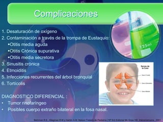 Adenoiditis y rinitis | PDF
