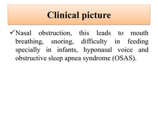 Adenoids.pptx ENT DISEASS OF UPER RESPIRATORY TRACT | PPTX | Ear, Nose ...