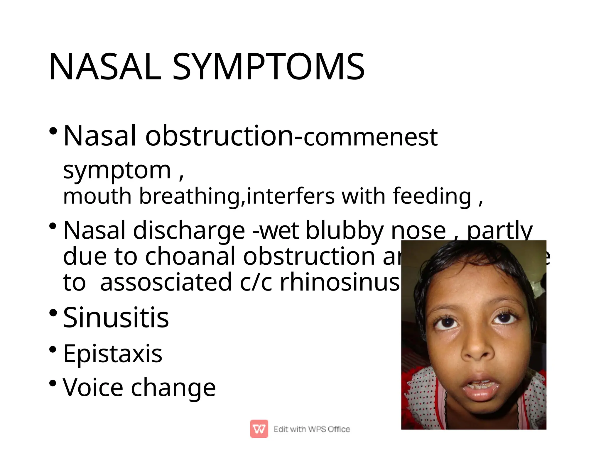 ADENOIDS-WPS Office(1).pptx ent ppt adenoids | PPTX