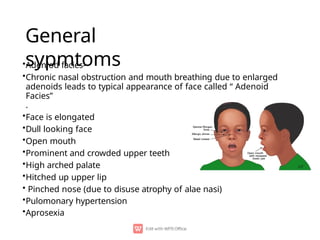 ADENOIDS-WPS Office(1).pptx ent ppt adenoids | PPTX