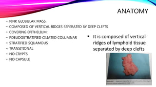 Adenoids,acute and chronic tonsillitis | PPTX