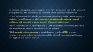 Adenoids and adenoidectomy | PPTX