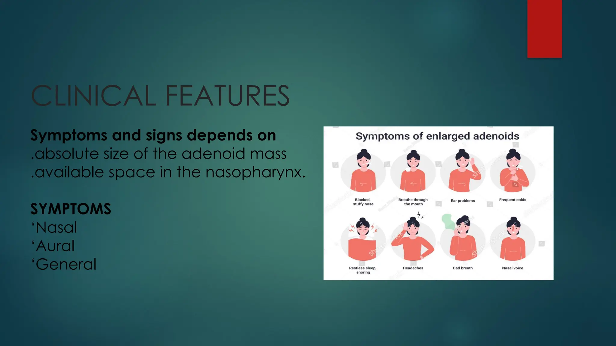 ADENOIDS PPT presentation .pptx education | PPTX