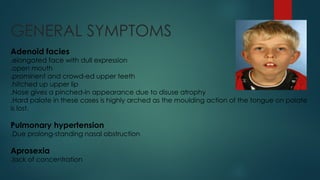 ADENOIDS PPT presentation .pptx education | PPT