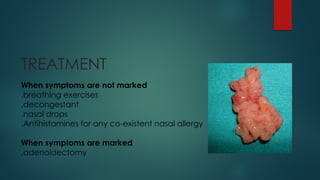 ADENOIDS PPT presentation .pptx education | PPT