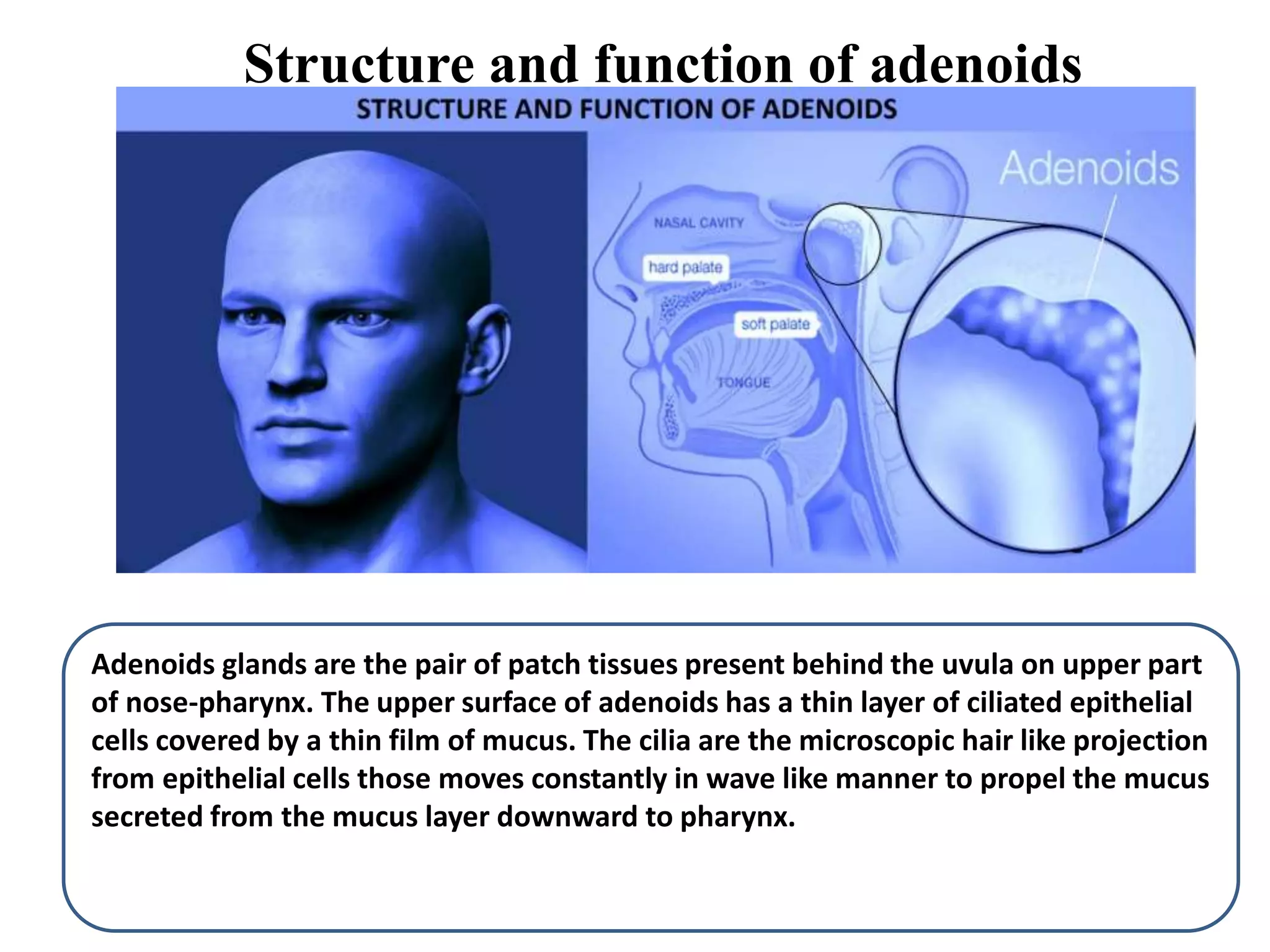 Homeopathic Medicines for ADENOIDS treatment | PPTX
