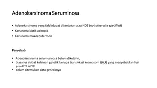 ADENOKARSINOMA SERUMINOSA (1).pptx pada telinga | PPTX