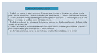 adenoma hipofisiario.pptx