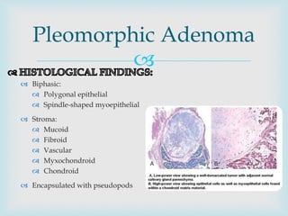 Adenomas | PPTX