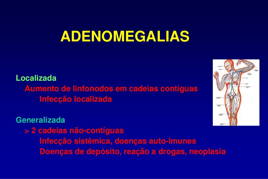 Adenomegalia