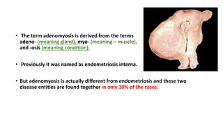 Adenomyosis .pdfhihhihihininijkjojjojojojojo | PDF
