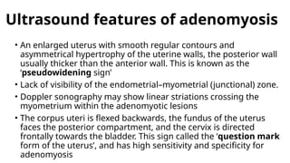 Adenomyosis .pptx adenomyosis adenomyosis and the uterus E-Placenta ...