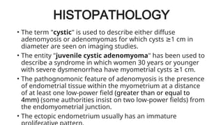 Adenomyosis .pptx adenomyosis adenomyosis and the uterus E-Placenta ...