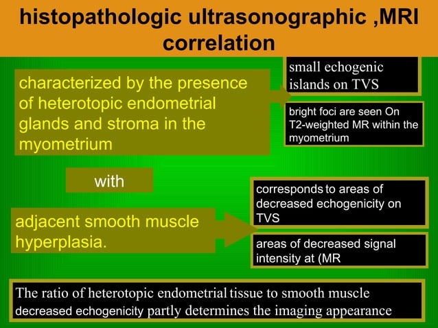 Adenomyosis Ppt