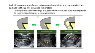 Diagnosing adenomyosis .pptx