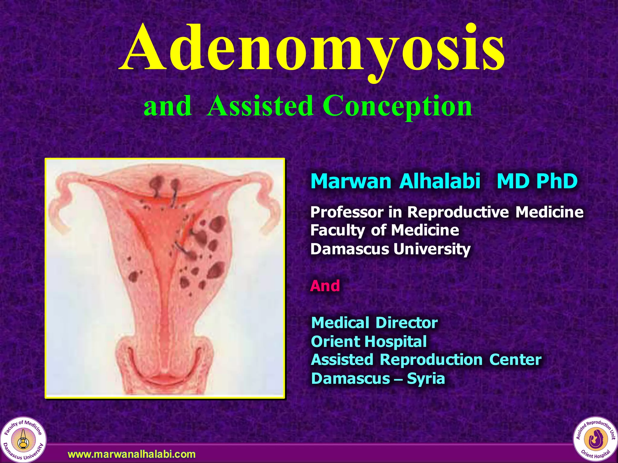 Adenomyosis and Assisted Conception | PDF