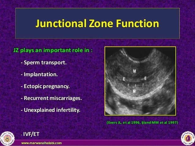 Adenomyosis and Assisted Conception