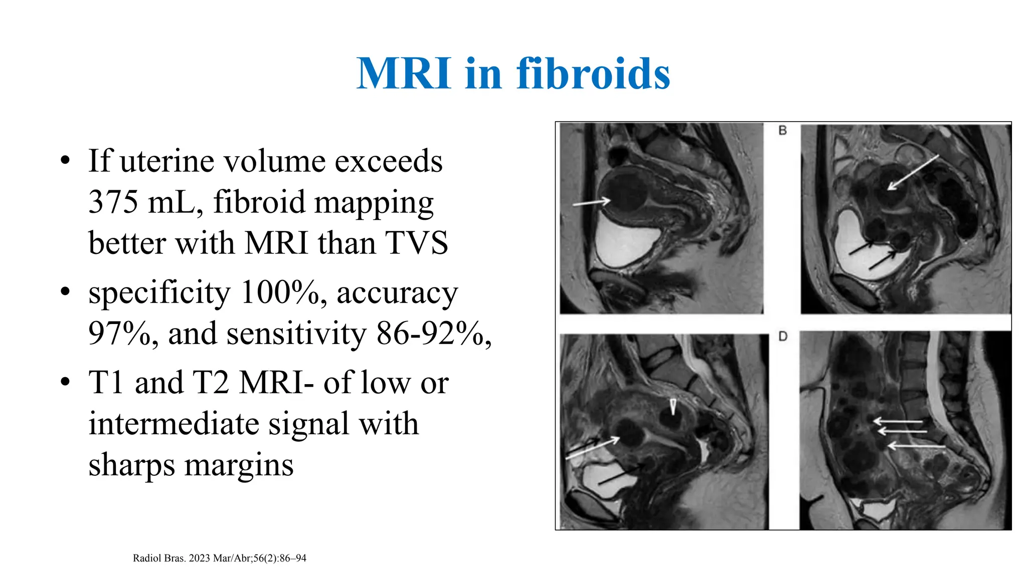 Adenomyosis or Fibroid- making right diagnosis | PPTX