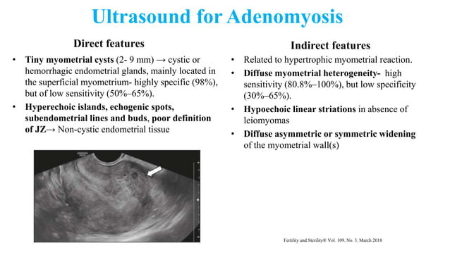 Adenomyosis or Fibroid- making right diagnosis | PPTX | Pregnancy | Reproductive Health