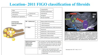 Adenomyosis or Fibroid- making right diagnosis | PPTX