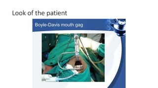 Adenotonsillectomy.pptx