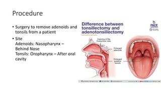 Adenotonsillectomy.pptx