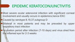 ADENOVIRAL-KERATOCONJUNCTIVITIS NIO&H Residency | PPTX