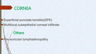 ADENOVIRAL-KERATOCONJUNCTIVITIS NIO&H Residency | PPTX