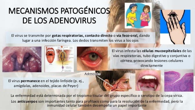 Adenovirus Sintomas