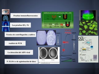 Descripción de Adenovirus Humano. Adenov | PPTX