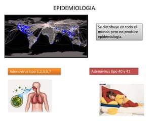 Descripción de Adenovirus Humano. Adenov | PPTX