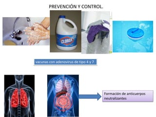 Descripción de Adenovirus Humano. Adenov | PPTX