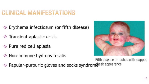 Adenovirus, papovavirus, parvovirus.pptx | Infectious Diseases ...
