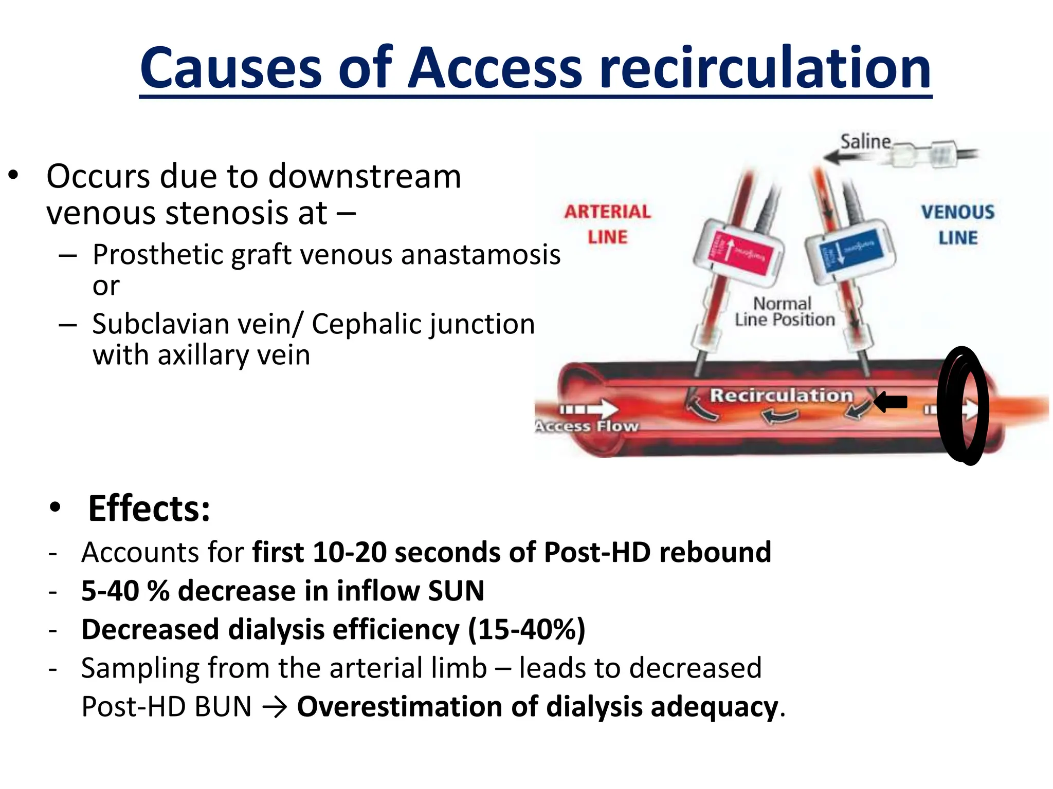 Adequacy_of_Hemodialysis.pptx