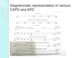 Adequacy of peritoneal dialysis and chronic peritoneal dialysis | PPTX