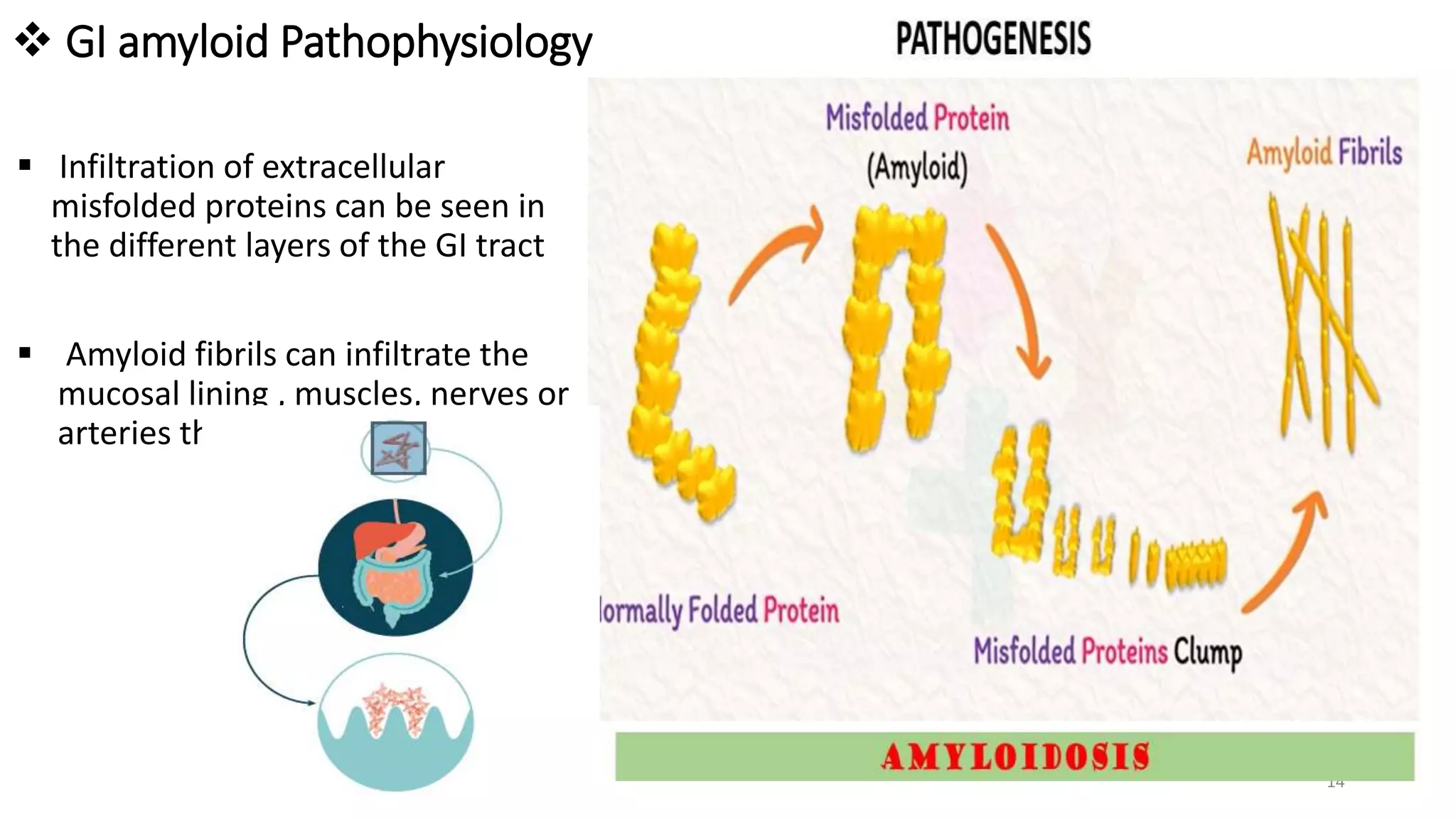 ad GI amyloidosis.pptx final.pptx
