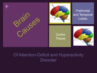 Adhd | PPTX