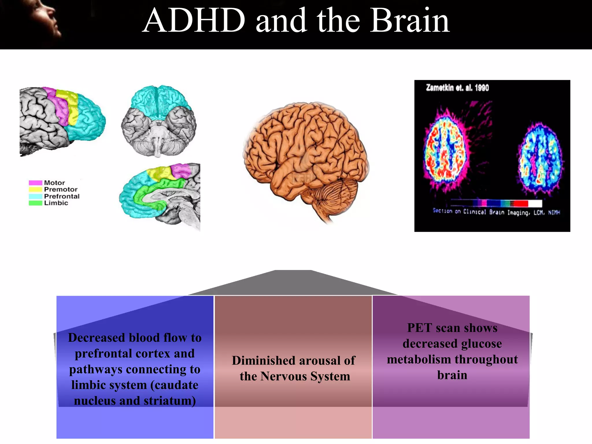 ADHD | PPT
