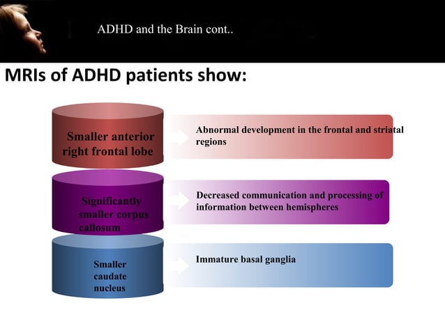 ADHD | PPT