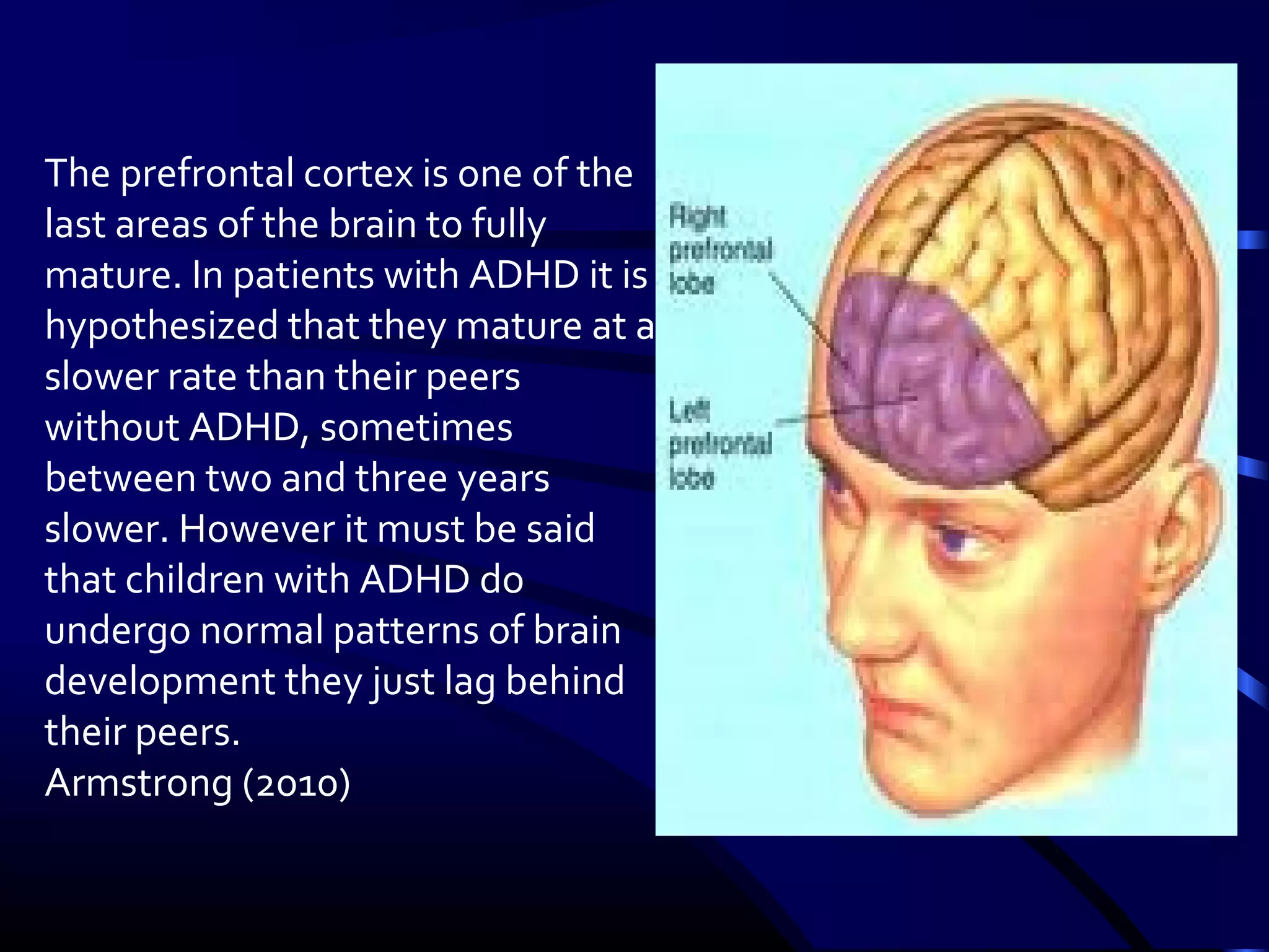 Attention Deficit Hyperactivity Disorder (ADHD) | PPT