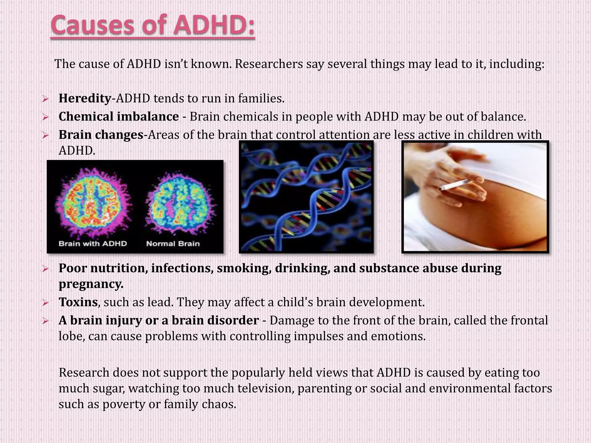 Adhd | PPTX
