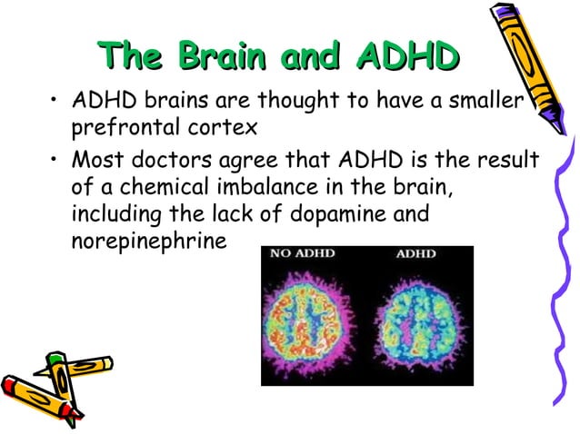 Adhd awareness project | PPT