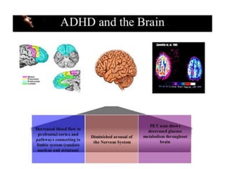 ADHD | PPTX