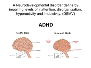 ADHD | PPTX