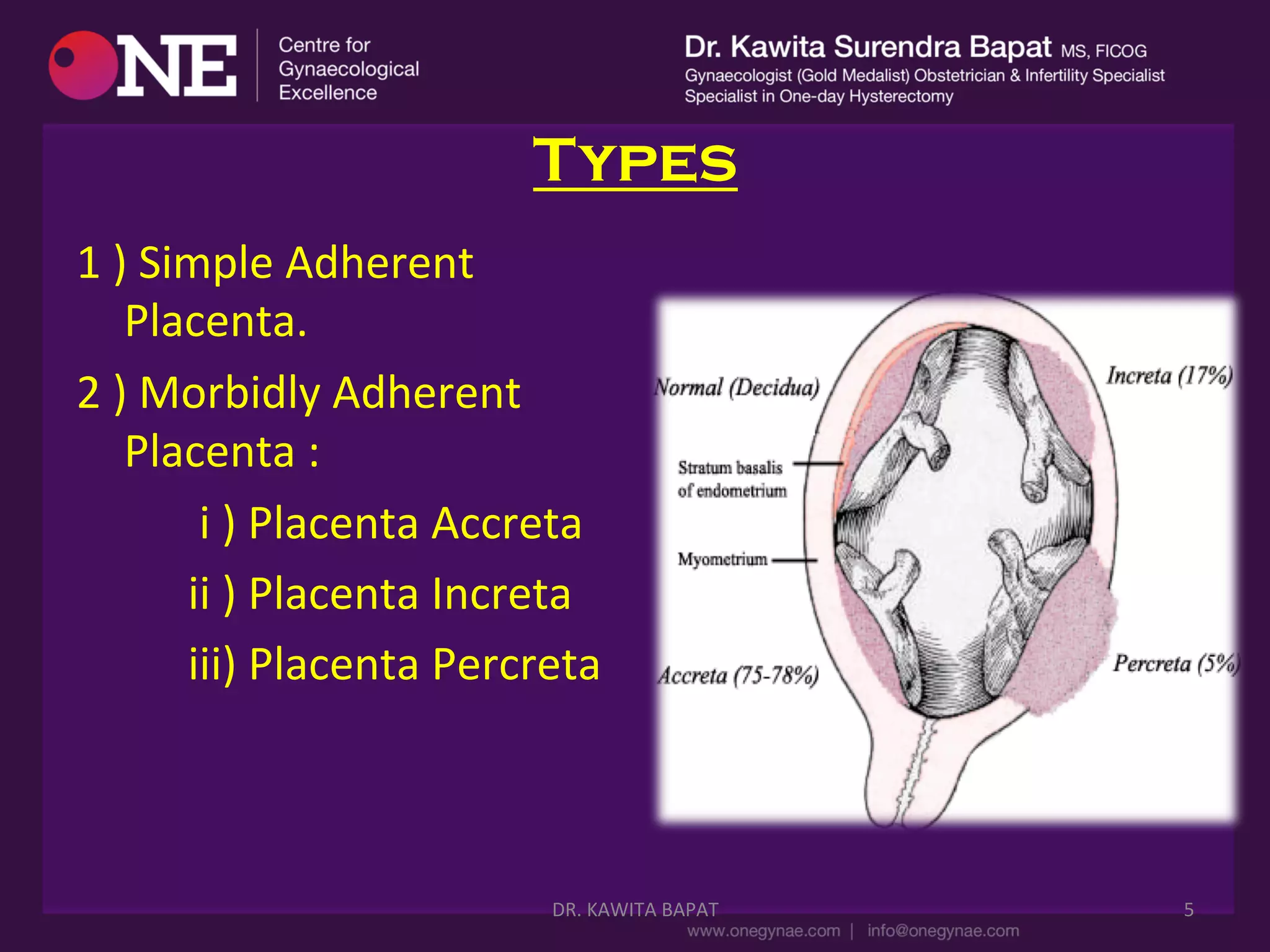 Adherent placenta | PDF