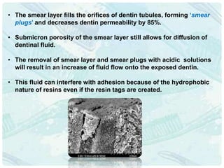 adhesion.pptx