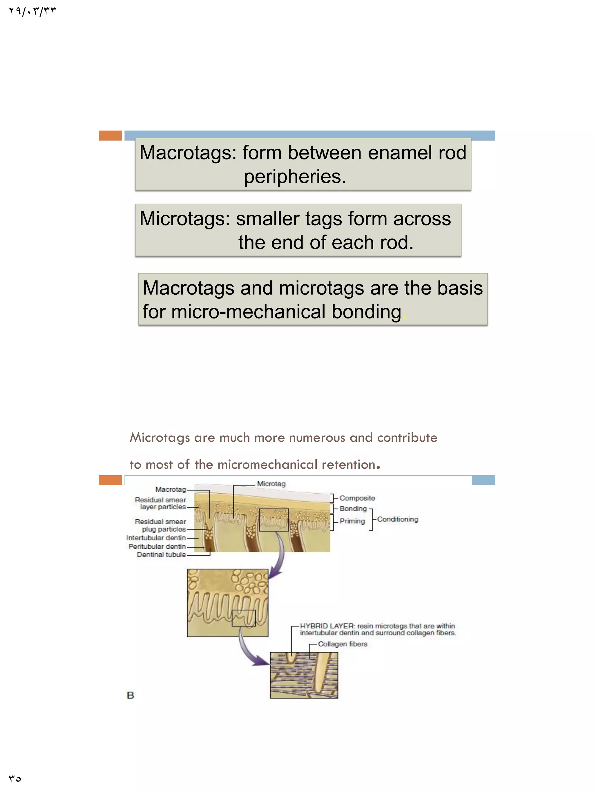 Adhesion in restorative dentistry | PDF