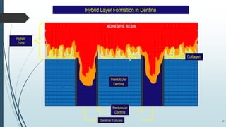 Adhesion and surface phenomenon | PPTX